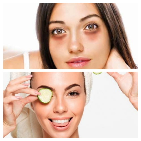 Olvídate para siempre de las ojeras con estos remedios naturales