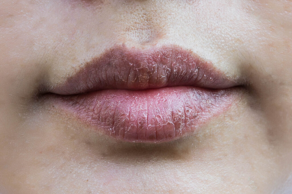 Los mejores consejos para tener unos labios perfectos